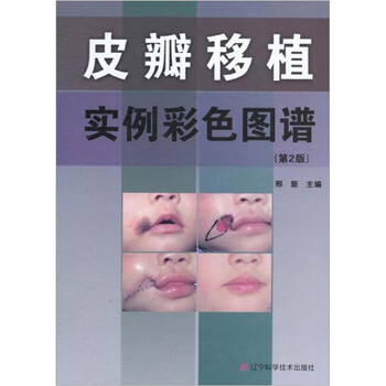 皮瓣移植实例彩色图谱（第2版）9787538168174