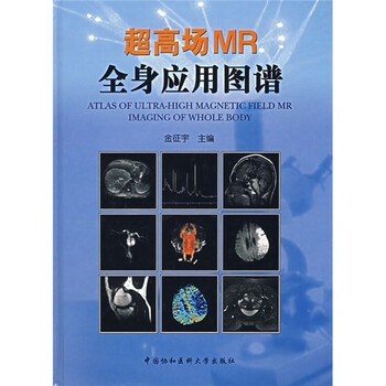 超高场MR全身应用图谱