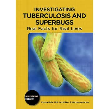 【】Investigating Tuberculosis and