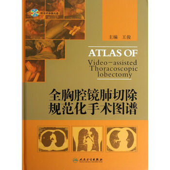 全胸腔镜肺切除规范化手术图谱(附光盘)(精)