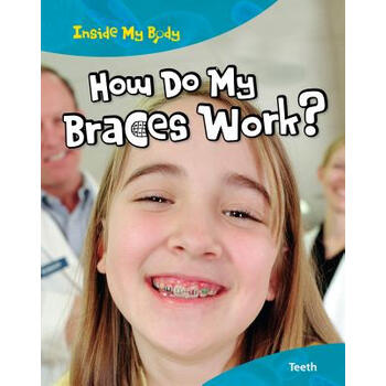 【】How Do My Braces Work?: Teeth