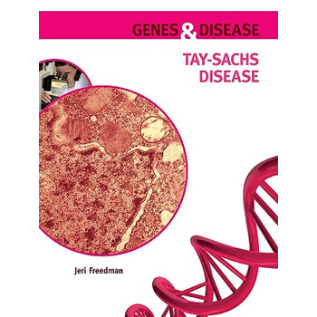 【】Tay-Sachs Disease