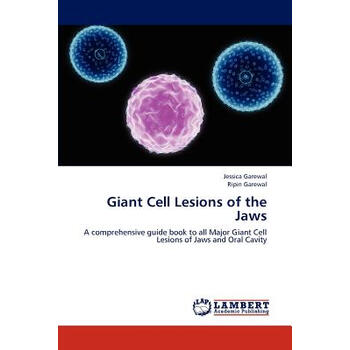 【】Giant Cell Lesions of the Jaws