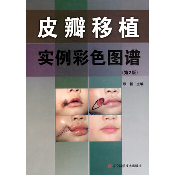 皮瓣移植实例彩色图谱(第2版)(精)