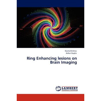 【】Ring Enhancing Lesions on Br