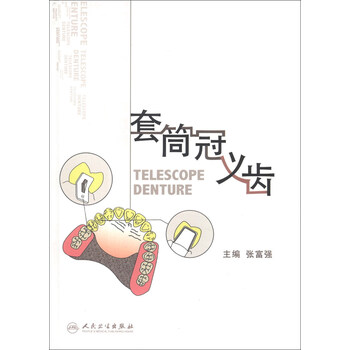 套筒冠义齿