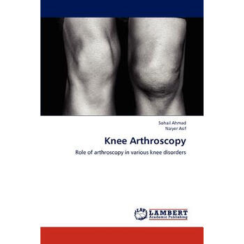 【】Knee Arthroscopy