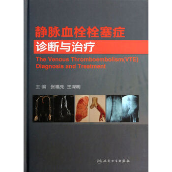 静脉血栓栓塞症诊断与治疗(精)