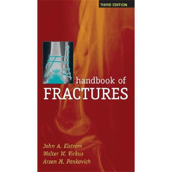 【】HANDBOOK OF FRACTURES