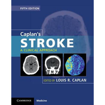 Caplan's Stroke: A Clinical Approach