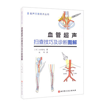 血管声扫查技巧及诊断图解