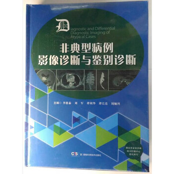 非典型病例影像诊断与鉴别诊断