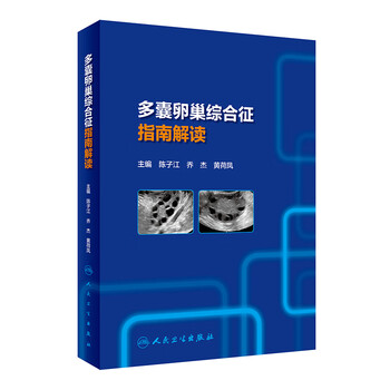 多囊卵巢综合征指南解读