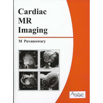 Cardiac M R Imaging