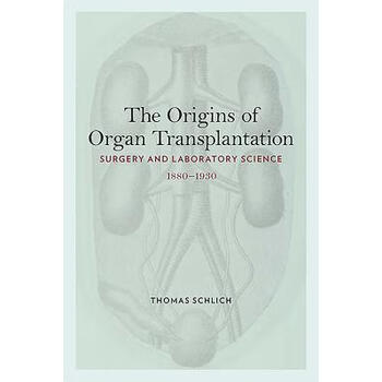 The Origins of Organ Transplantation: Surgery a