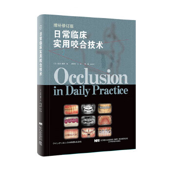 日常临床实用咬合技术