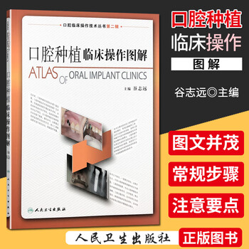 口腔种植临床操作图解 口腔临床操作技术丛书第二辑 人民卫生出版社