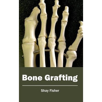 Bone Grafting