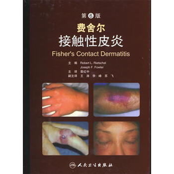 费舍尔接触性皮炎 晋红中　主译【正版书】