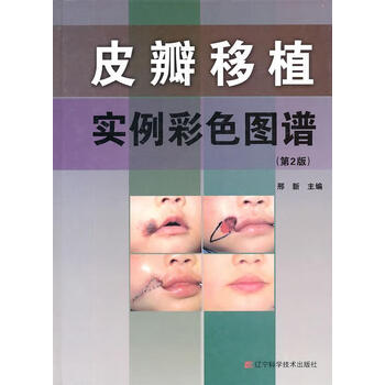 皮瓣移植实例彩色图谱（第2版） 邢新　 医学 9787538168174