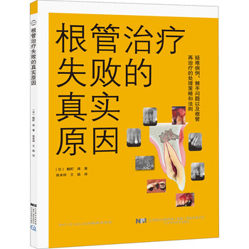 根管治疗失败的真实原因