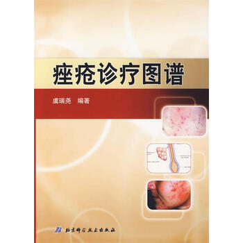 痤疮诊疗图谱 虞瑞尧 编著【正版书】