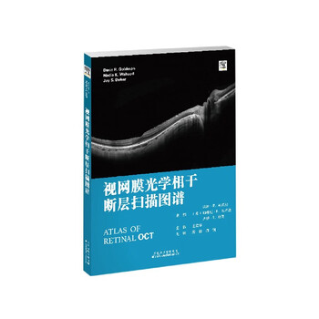 视网膜光学相干断层扫描图谱(精)