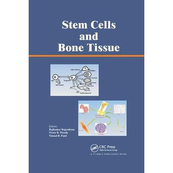 Stem Cells and Bone Tissue