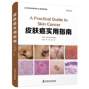 皮肤癌实用指南