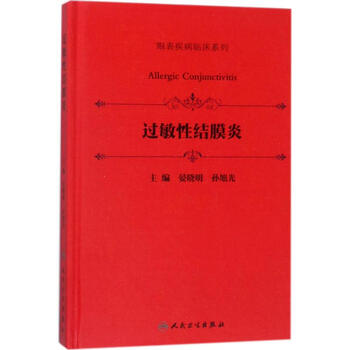 过敏性结膜炎 晏晓明,孙旭光 主编