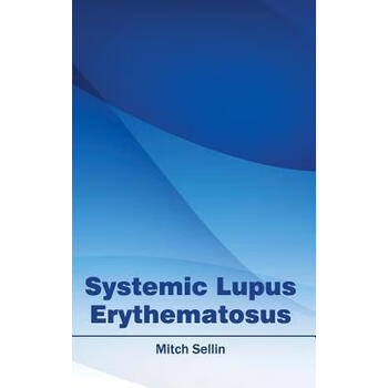 Systemic Lupus Erythematosus