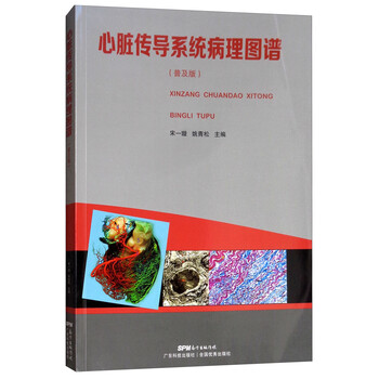 心脏传导系统病理图谱（普及版）