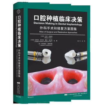 口腔种植临床决策(外科手术和修复方案图集)(精)