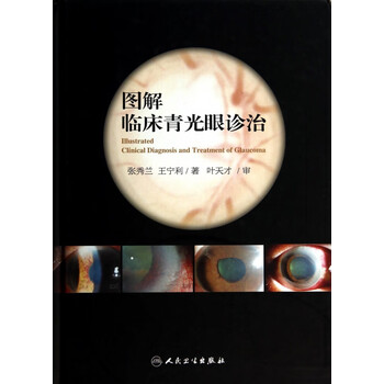 图解临床青光眼诊治(精)