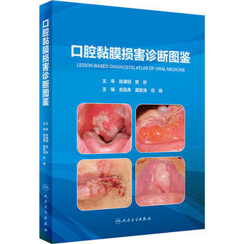 口腔黏膜损害诊断图鉴