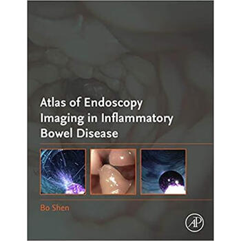 Atlas of Endoscopy Imaging in Inflammatory Bowel