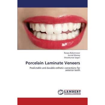 Porcelain Laminate Veneers