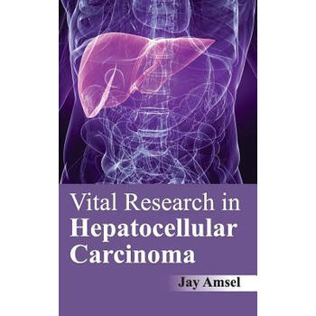 Vital Research in Hepatocellular Carcinoma