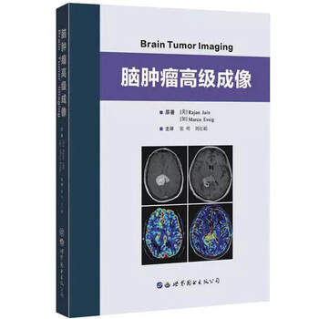 脑肿瘤高级成像