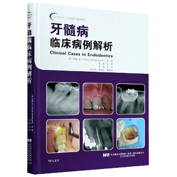 牙髓病临床病例解析(精)