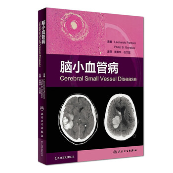 脑小血管病