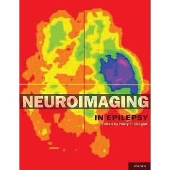 高被引Neuroimaging in Epilepsy