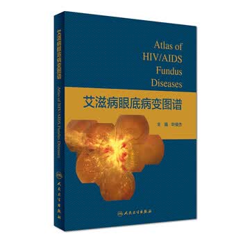 艾滋病眼底病变图谱