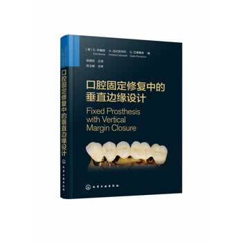 口腔固定修复中的垂直边缘设计