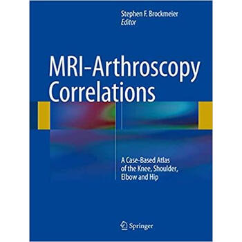 Mri-Arthroscopy Correlations: A Case-Based Atlas