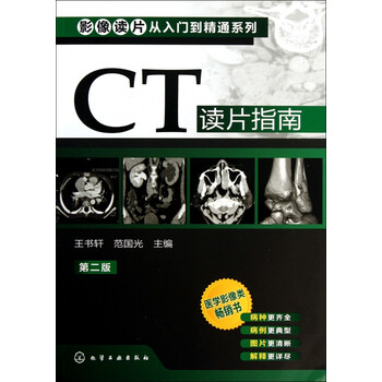 CT读片指南(第2版)/影像读片从入门到精通系列