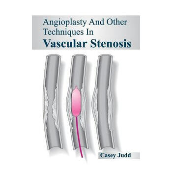 Angioplasty and Other Techniques in Vascular Ste