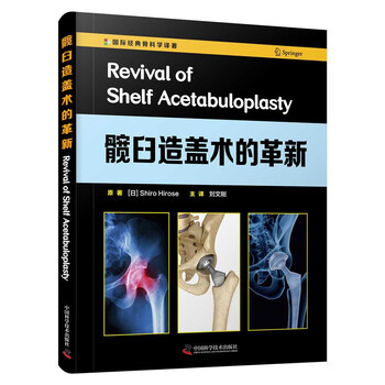髋臼造盖术的革新