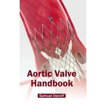 Aortic Valve Handbook