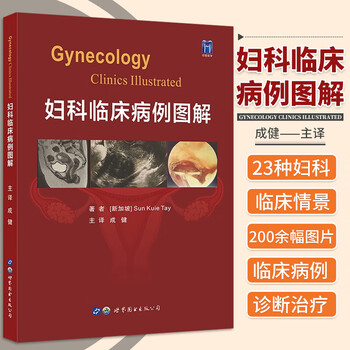 妇科临床病例图解 妇科学 从主诉入手讨论23种妇科临床常见情景所涉及的疾病进行详细阐述 适用于妇科医学生及住院医师等参考使用